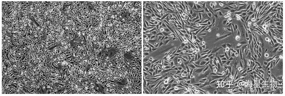 3T3-L1细胞成脂诱导注意要点 - 知乎