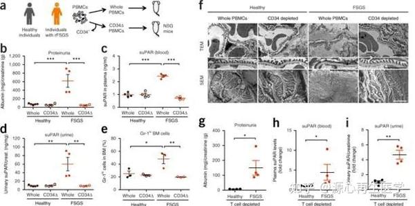 Nature子刊丨suPAR被证实为CKD的长期风险因素，其调控作用对治疗的意义更显著 - 知乎
