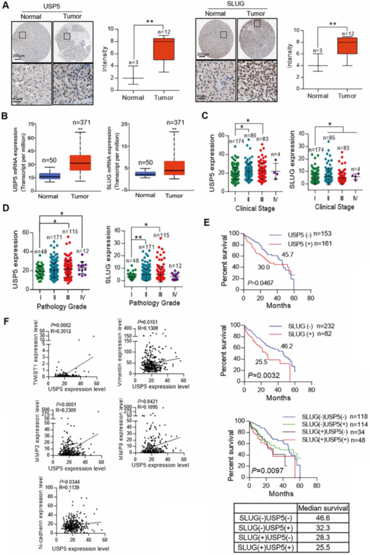 USP5通过稳定肝细胞癌的SLUG促进上皮-间质转化 - 知乎