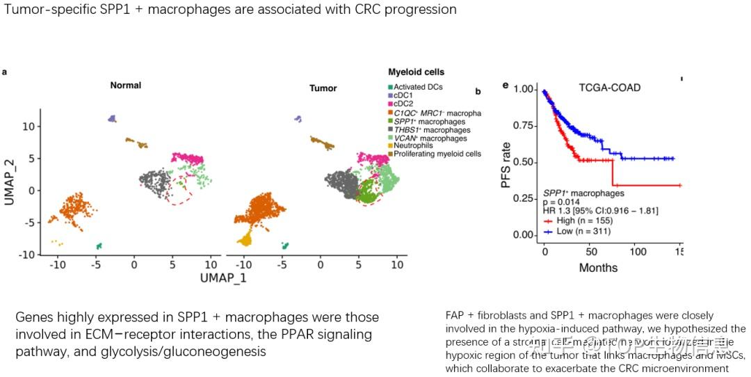 文献(8): 单细胞和空间分析揭示FAP+成纤维细胞和SPP1+巨噬细胞在结直肠癌中的相互作用 - 知乎