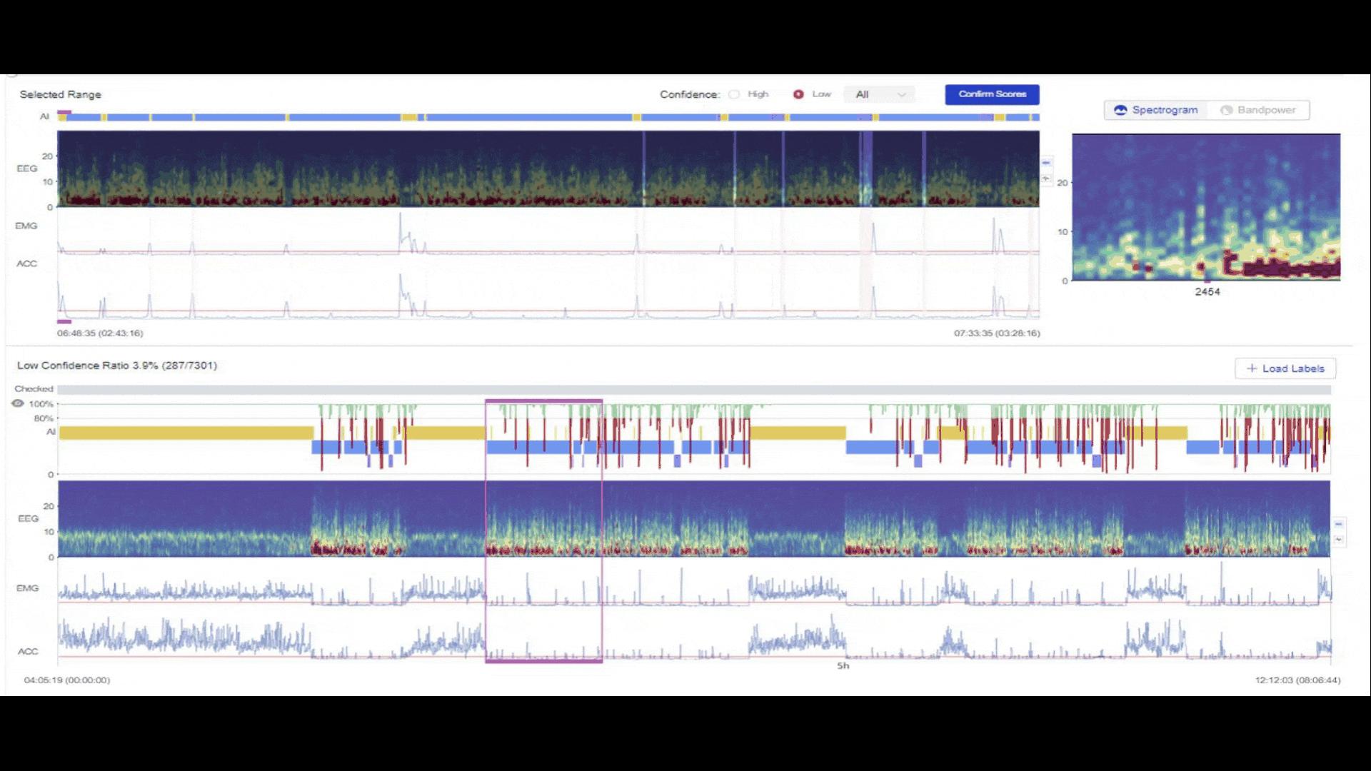 睡眠分期 | Lunion Stage 脑电分析平台 - 知乎