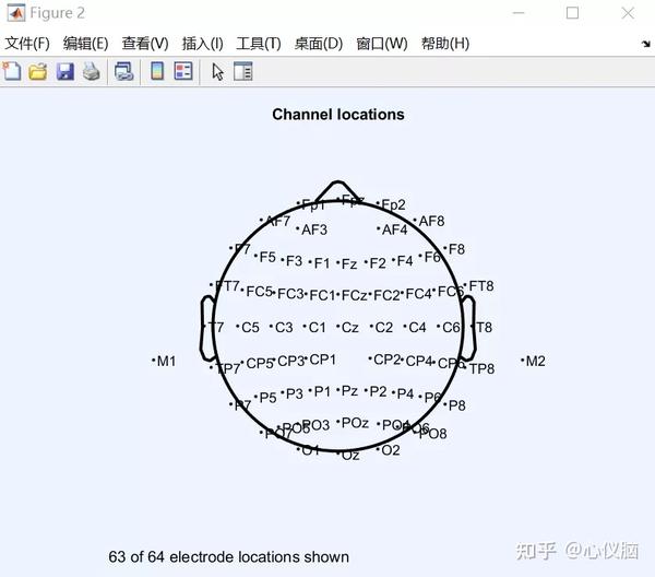 EEGLAB如何进行ERPs数据处理你都会了吗？看这里保证你一劳永逸的get ERPs数据处理技能 - 知乎