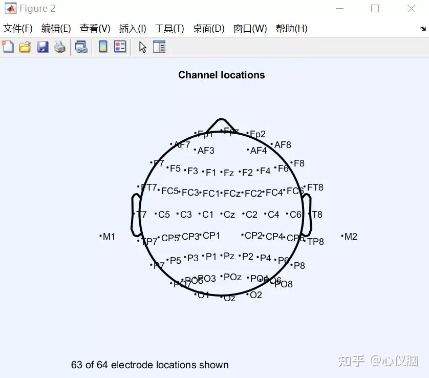 EEGLAB如何进行ERPs数据处理你都会了吗？看这里保证你一劳永逸的get ERPs数据处理技能 - 知乎