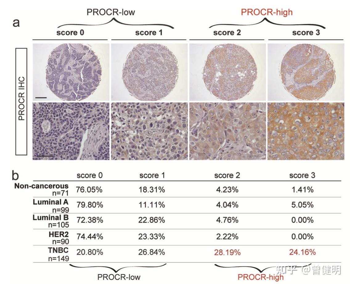 免疫组化和RNA-seq数据你更相信哪个 - 知乎