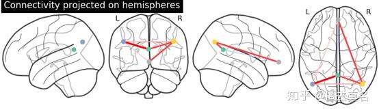 Nilearn：基于Python语言神经成像的机器学习（6） - 知乎