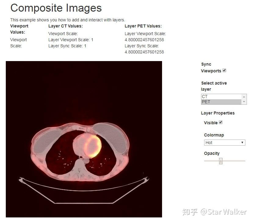 从Cornerstone到OHIF Viewer—JS影像前端开发最佳范例 - 知乎