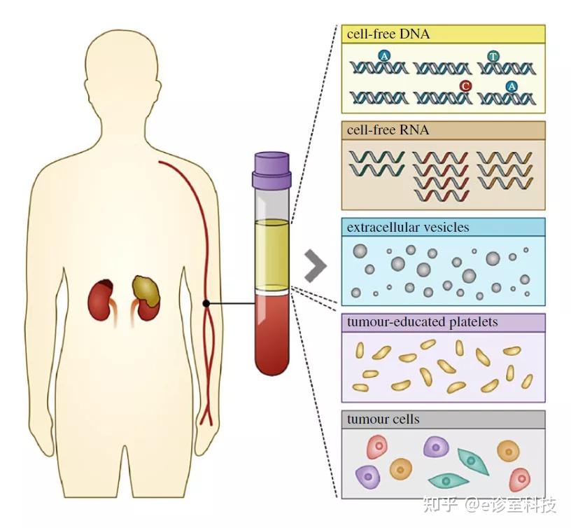 基于ctDNA的MRD检测解析 - 知乎