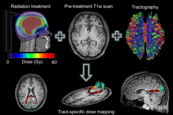 磁共振弥散成像(dMRI)分析方法 - 知乎