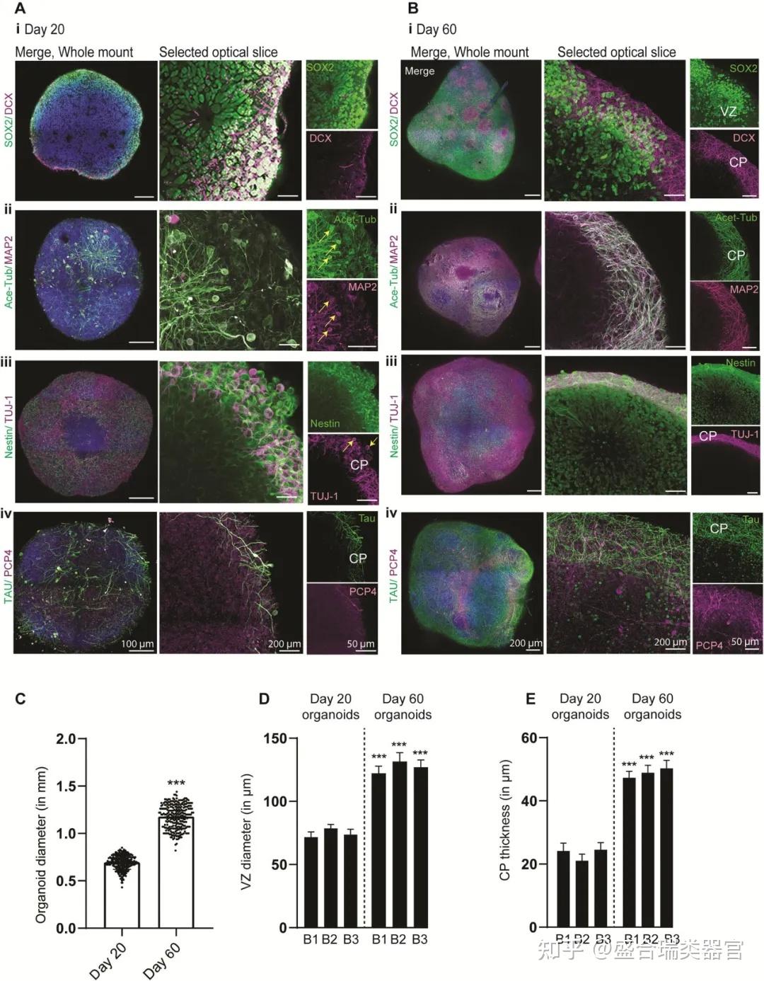 Nature子刊：如何使用6个iPSC细胞系产生1万多个脑类器官？ - 知乎