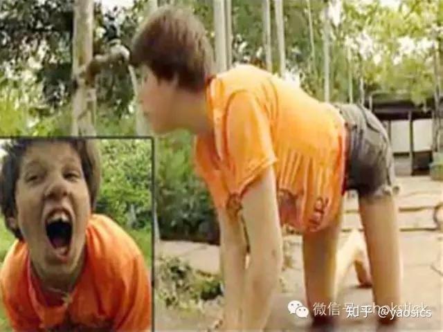 那些被鸡被狼被狗...养大的孩子们，现在活得还好吗？ - 知乎