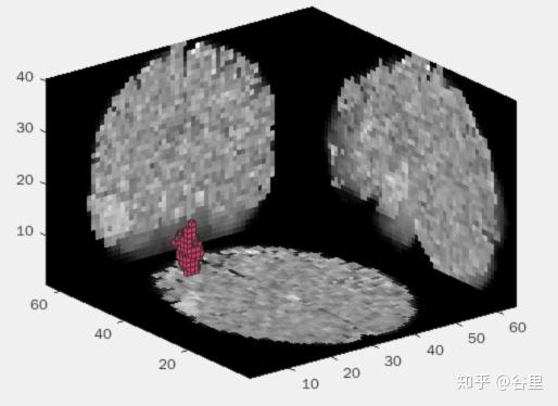 任务态fMRI MVPA解码与the decoding toolbox - 知乎