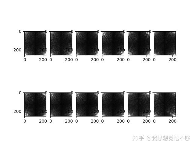 MRI重建中的小实验（python） - 知乎