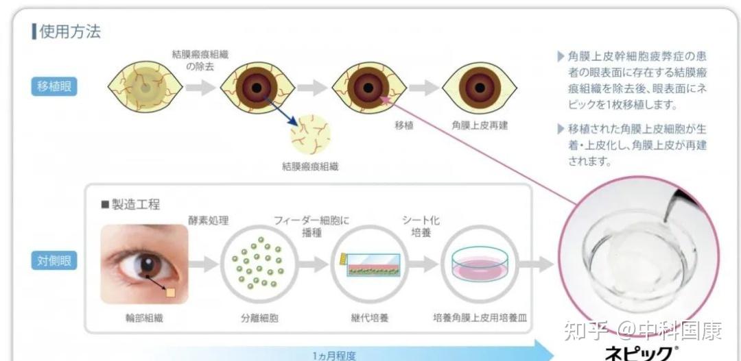 眼睛角膜的拯救者：干细胞重建角膜恢复视力 - 知乎