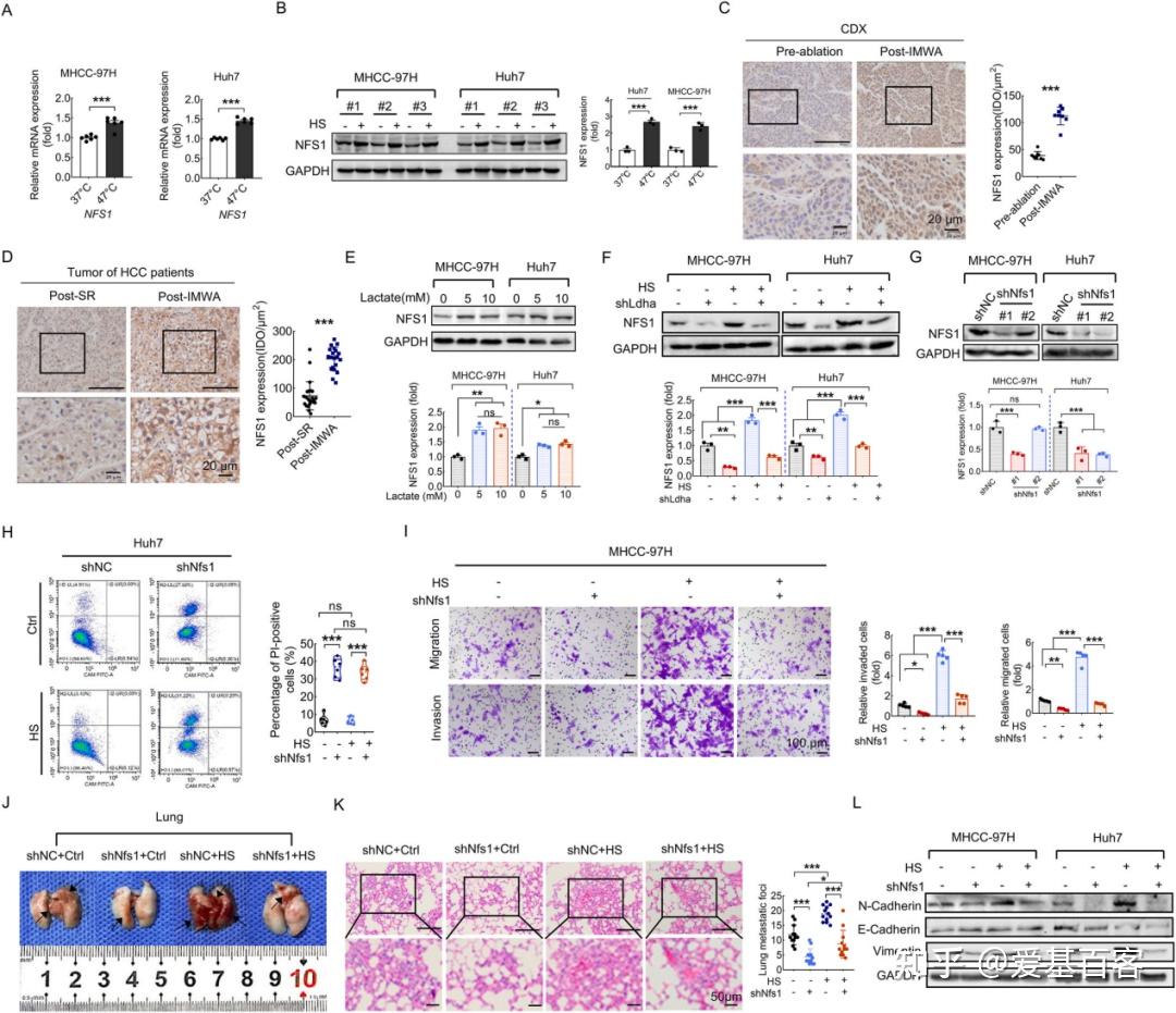 项目文章 | Redox Biology组蛋白乳酸化在肝癌微波消融术后转移中的作用机制 - 知乎