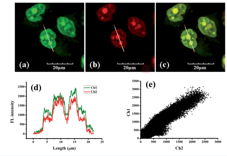 Imagej图像处理实践（ImageJ学习-图像处理 545367350） - 知乎