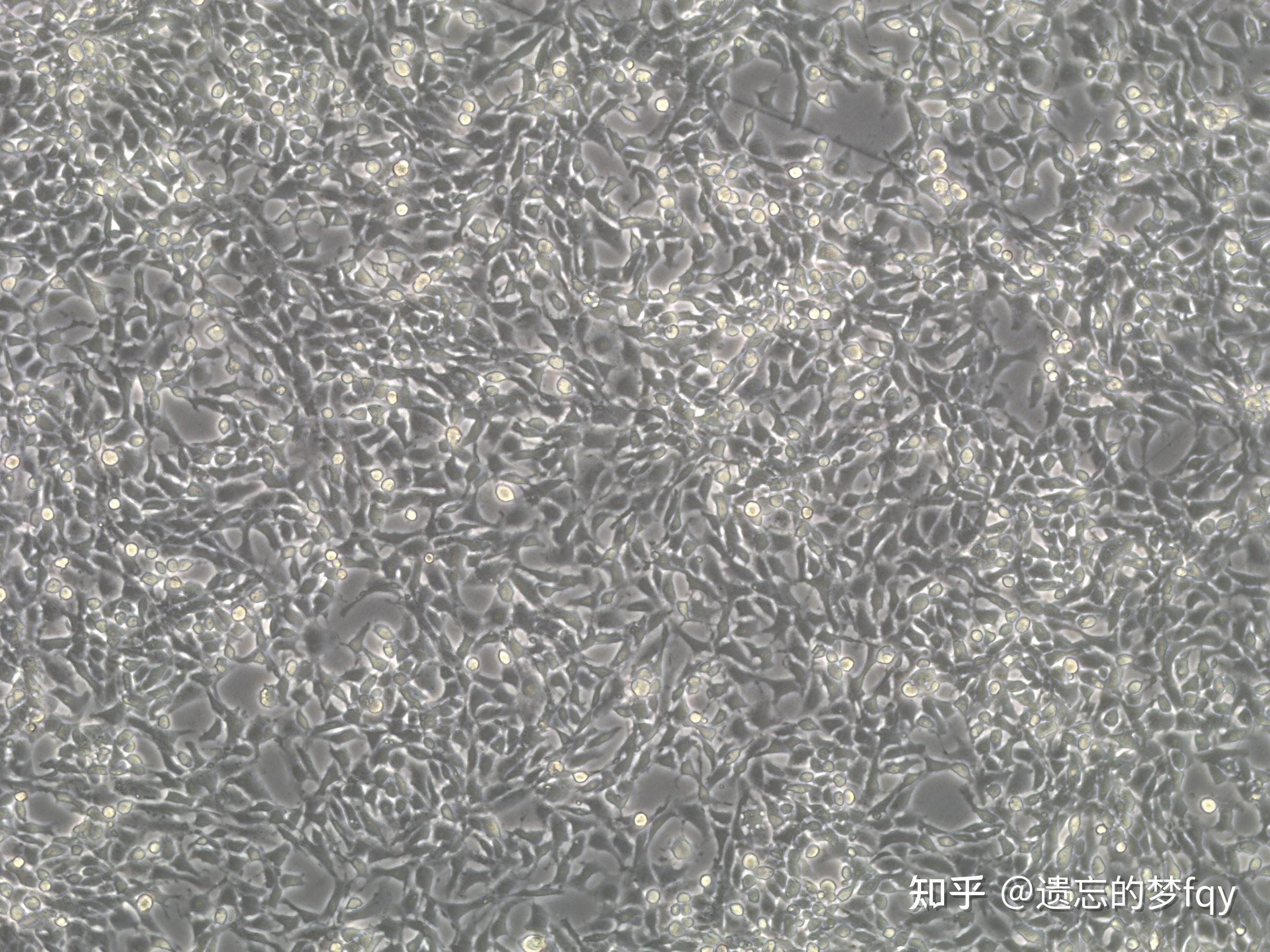 细胞形态之MLE-12 - 知乎