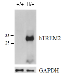 炎症和肿瘤免疫治疗领域新靶点：TREM1&TREM2 - 知乎