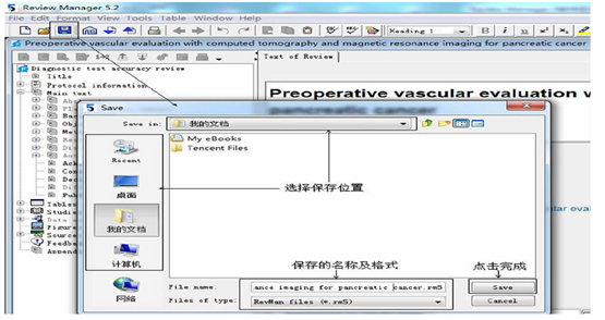 RevMan 软件实现病因或预后类 Meta 分析的数据转换 - 知乎