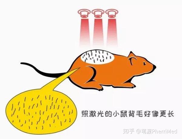 低能量激光生发治疗LLLT（Low-Level Laser Therapy） - 知乎