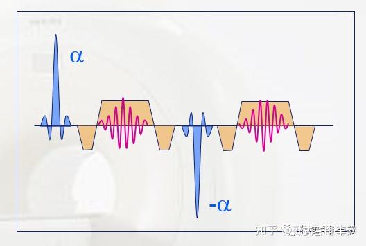 磁共振序列之bSSFP序列 - 知乎