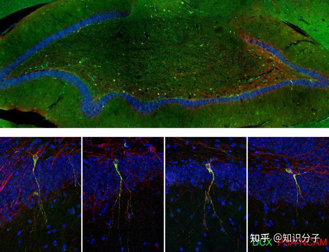 复旦神经科学家：成年人脑内不再有新生神经元｜ 争鸣 - 知乎