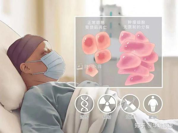 为什么说细胞增殖标志物TK1是更好的泛癌早筛指标？ - 知乎