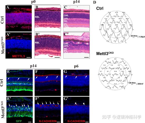 eLife︱中山大学中山眼科中心陈舒怡团队首次揭示神经祖细胞与神经胶质细胞状态转换的m6A表观转录调控机制 - 知乎