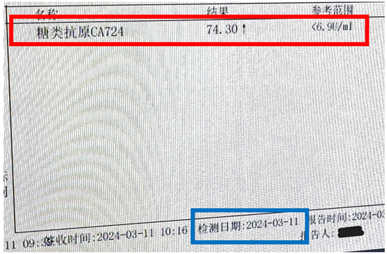 恰当看待血清CA724升高 - 知乎