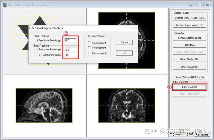 DTI Studio操作教程 - 知乎