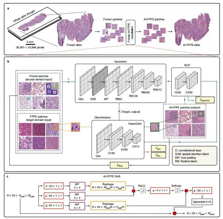 Nat Biomed Eng | 将组织图像从冷冻切片转变为FFPE的深度学习模型 - 知乎