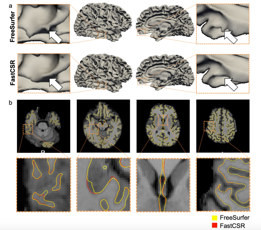 刘河生教授团队开发更高效、更准确的基于磁共振图像的大脑皮层重建技术 - 知乎