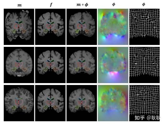 [论文笔记] VoxelMorph - 知乎