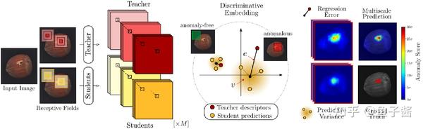 详解一篇异常检测经典作：基于teacher-students的无监督异常检测 - 知乎