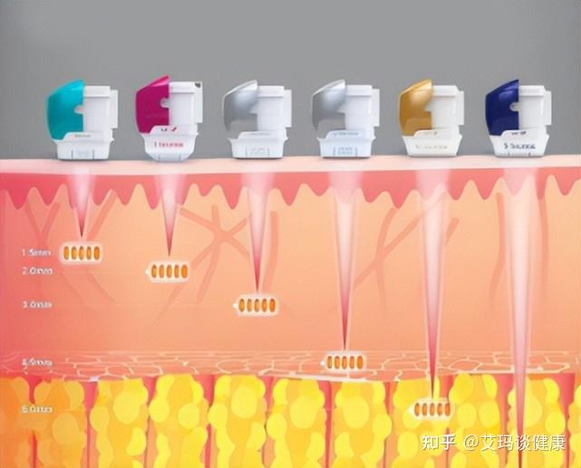 对比来了！7d聚拉提和fotona4d区别：7d聚拉提后的注意事项！ - 知乎