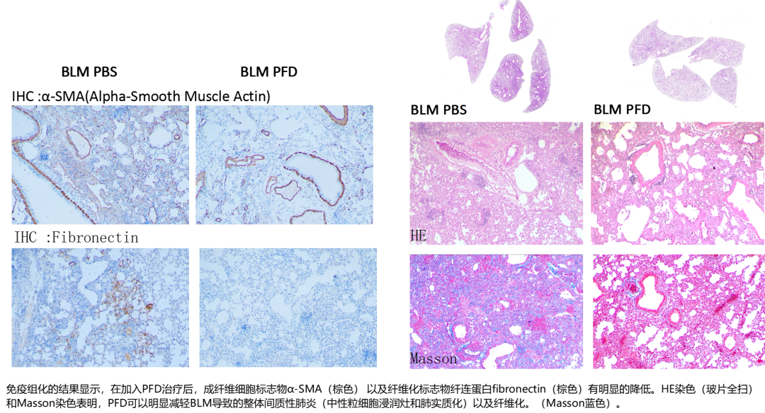 探索肺的奥秘：IPF特发性肺纤维化小鼠模型药效评价报告 - 知乎
