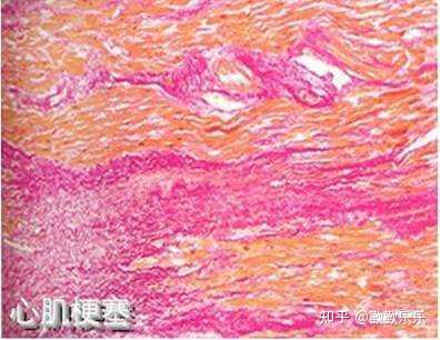 动物实验 病理染色：Van Gieson染色实验 - 知乎