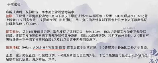 深圳大学总医院温德幸：ADM-H内置生物套无痕治疗小阴茎 - 知乎