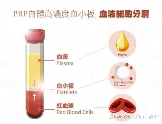 一文带你了解PRP在康复的广泛应用 - 知乎