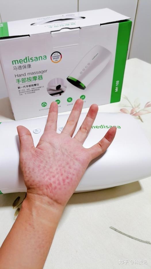 medisana MH103手部按摩器：舒缓手部酸痛的好帮手 - 知乎