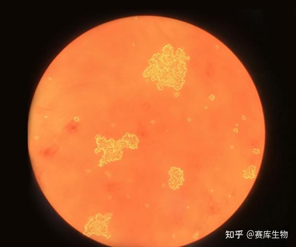 细胞学堂|293T细胞贴壁性差，容易漂？转染病毒后凋亡严重？293T培养诀窍盘点！ - 知乎