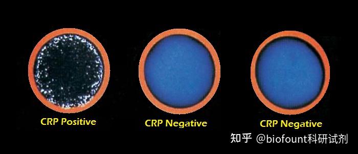 C-反应蛋白 (CRP) 测试：介绍、原理、步骤和解释 - 知乎