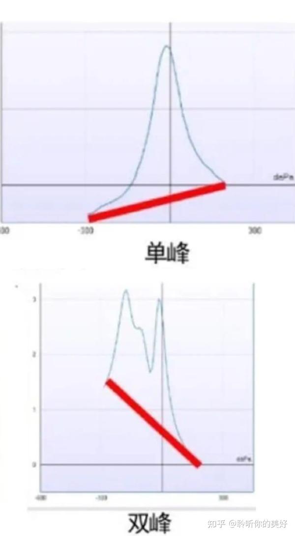 简单“话”检查--鼓室声导抗 - 知乎