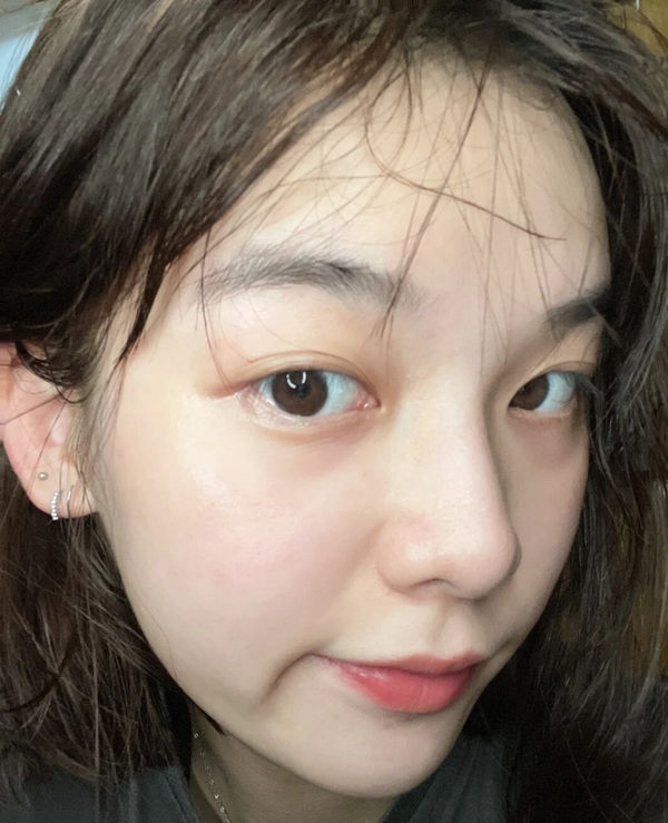 男生黑眼圈重该怎么办？ 知乎