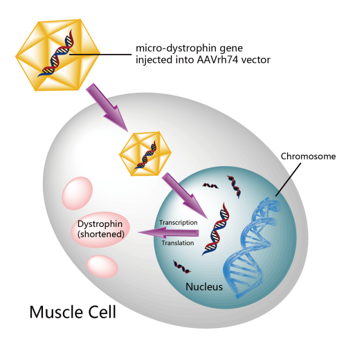 FDA九个月内批准的三种DMD治疗方法 - 知乎