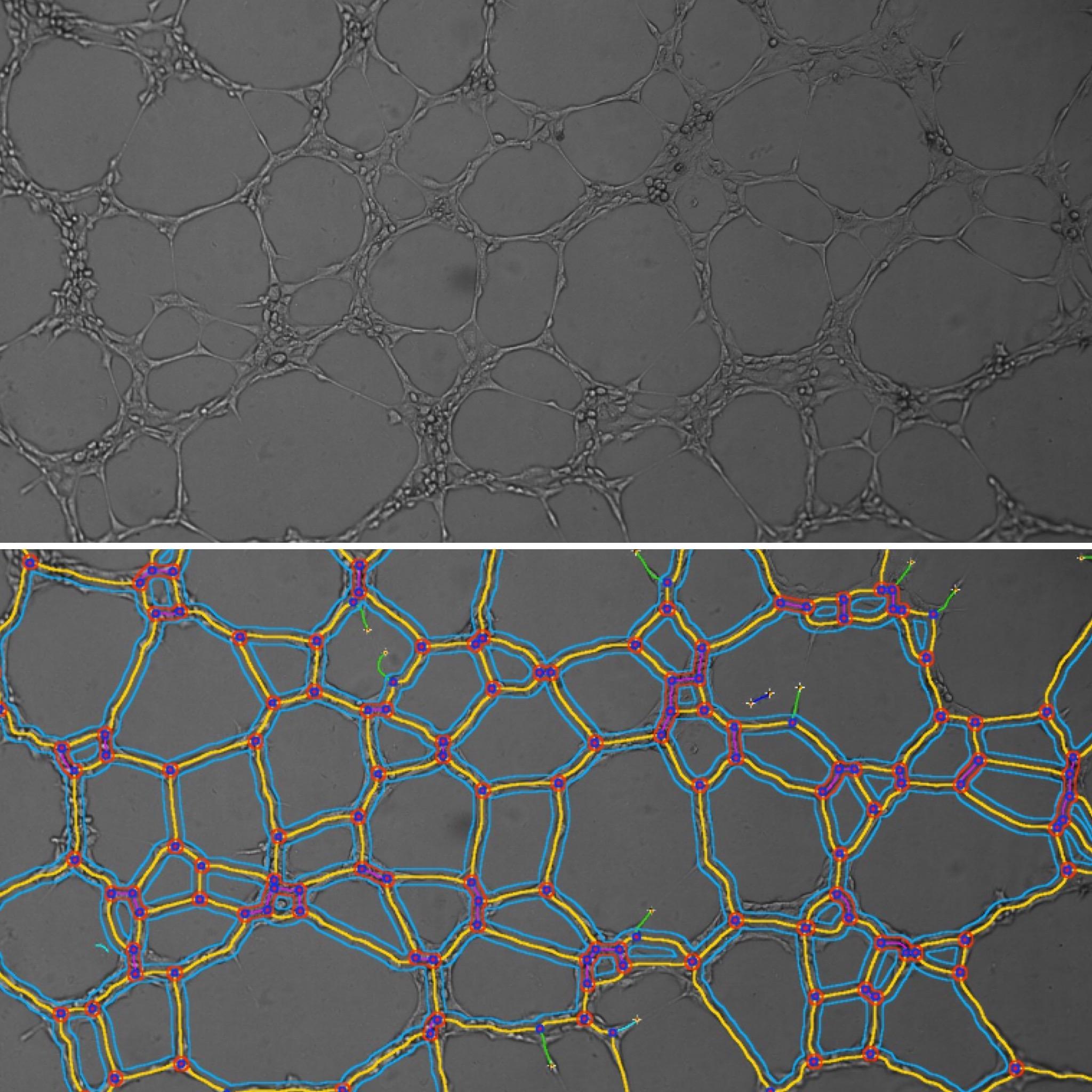 Matrigel-based tube formation assay 检测条件培养基的新生血管能力 - 知乎