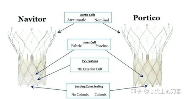 连合对齐（Commissural Alignment）：原理、定义、技术和结果（中） - 知乎