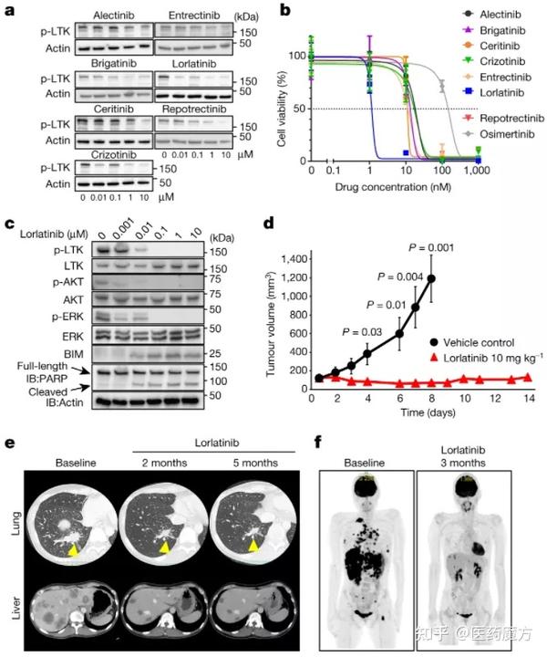 Nature里程碑：非小细胞肺癌新靶点——CLIP1-LTK - 知乎