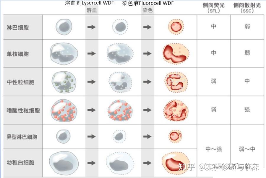 【临检基本功】如何看懂血细胞直方图与散点图（建议收藏） - 知乎