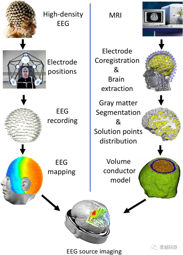 EEG源定位 - 知乎