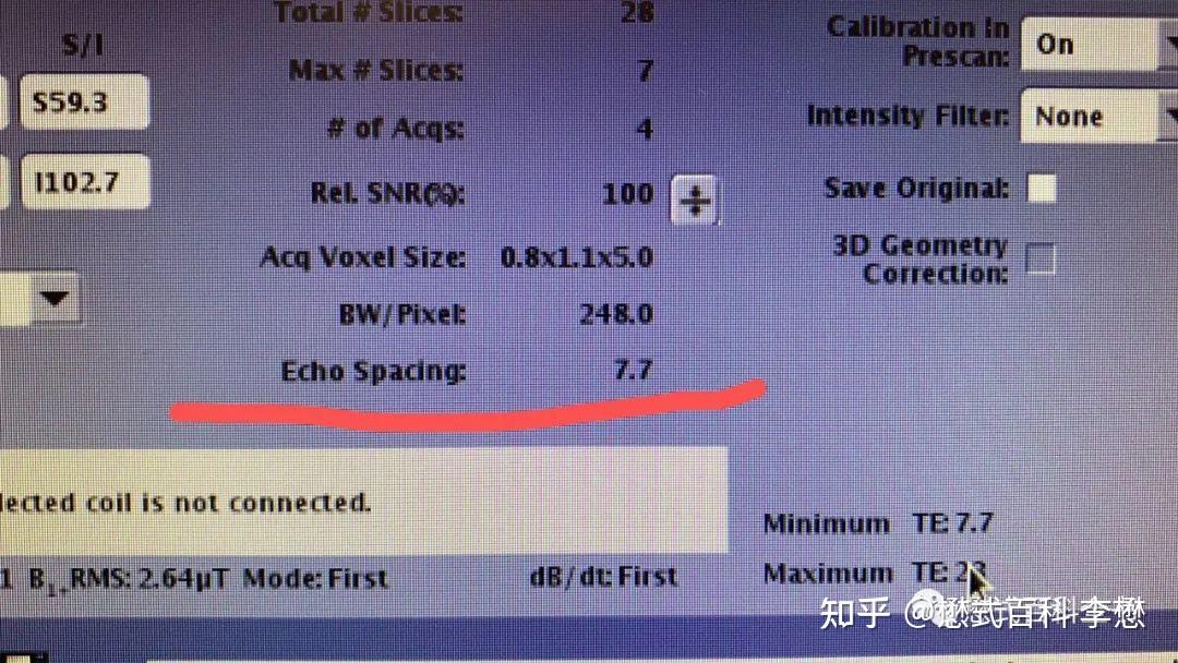 磁共振参数之回波间隔 - 知乎